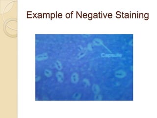 Anatomy of prokaryotic cells | PPTX