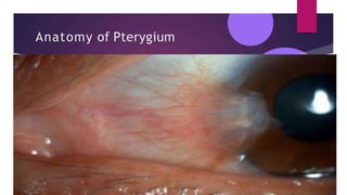 Anatomy of Pterygium.pptx