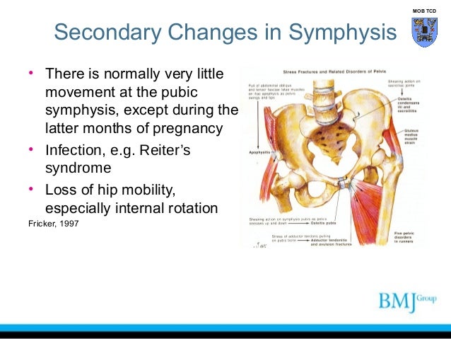 Anatomy of pubic symphysis and sacroiliac joint (www.Am-medicine.com)