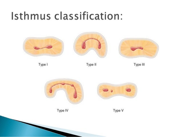 Anatomy of Dental Pulp