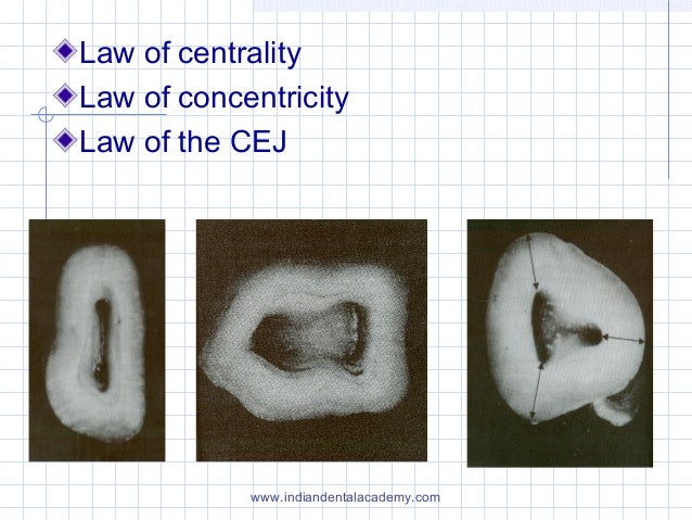 Anatomy of pulp/cosmetic dentistry courses