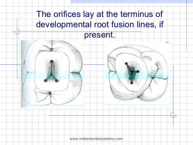 Anatomy of pulp/cosmetic dentistry courses
