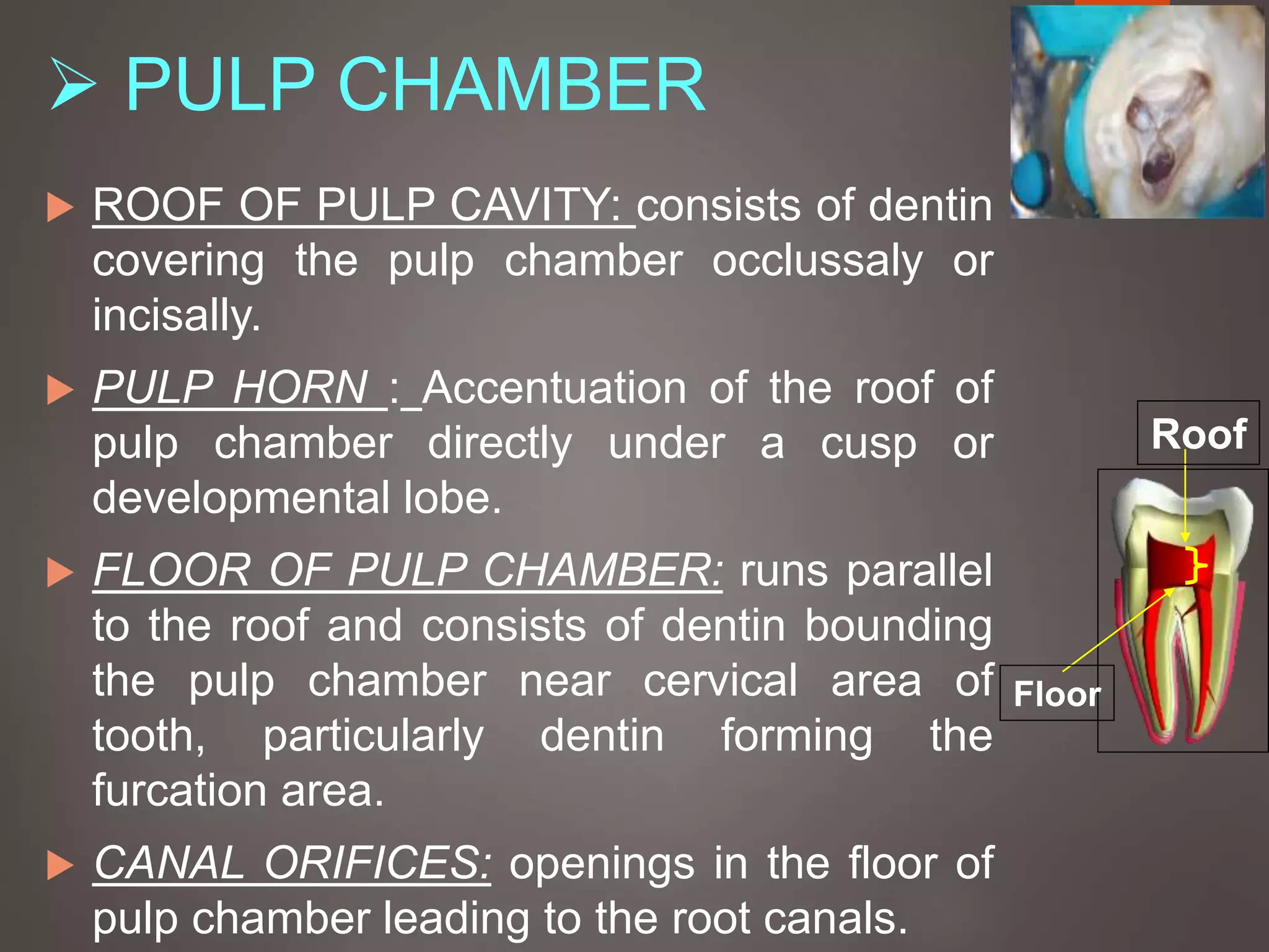 Anatomy of pulp space | PPTX