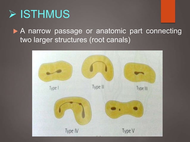 Anatomy of pulp space | PPTX | Dental Health | Diseases and Conditions
