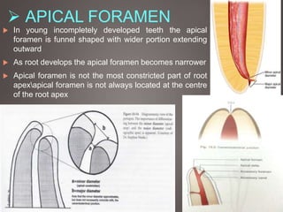 Anatomy of pulp space | PPTX