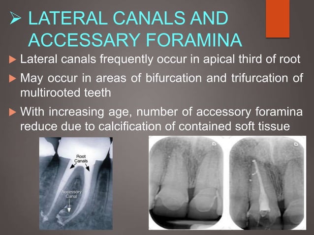 Anatomy of pulp space | PPTX | Dental Health | Diseases and Conditions