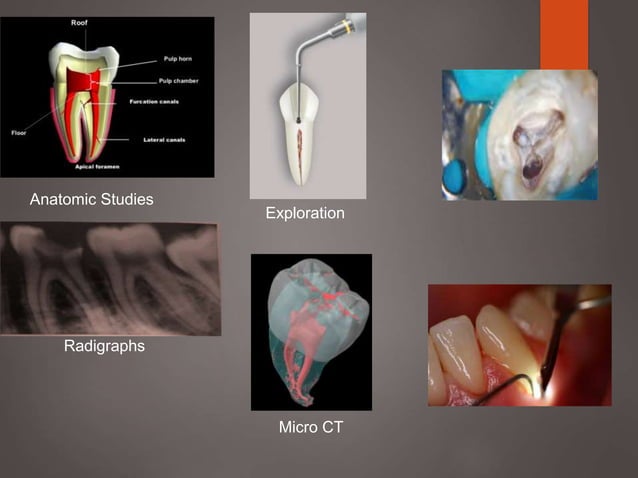 Anatomy of pulp space | PPT