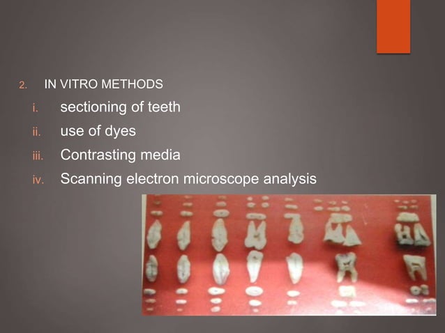 Anatomy of pulp space | PPTX | Dental Health | Diseases and Conditions