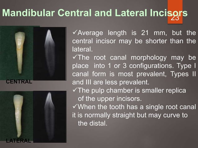 Anatomy of pulp space | PPT
