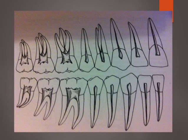 Anatomy of pulp space | PPTX | Dental Health | Diseases and Conditions