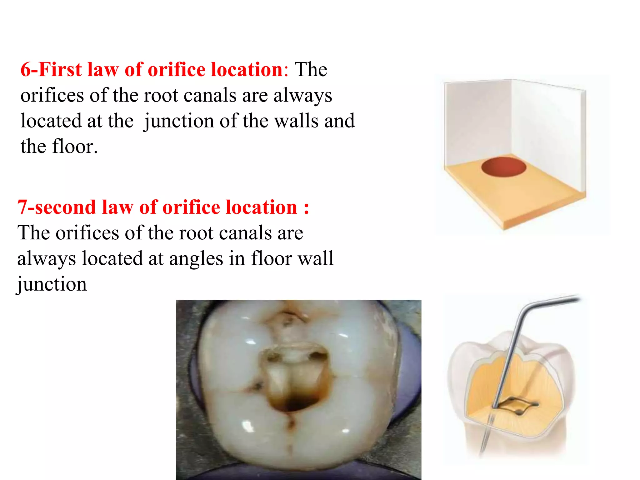 Anatomy of pulp canal and its access opening | PPTX