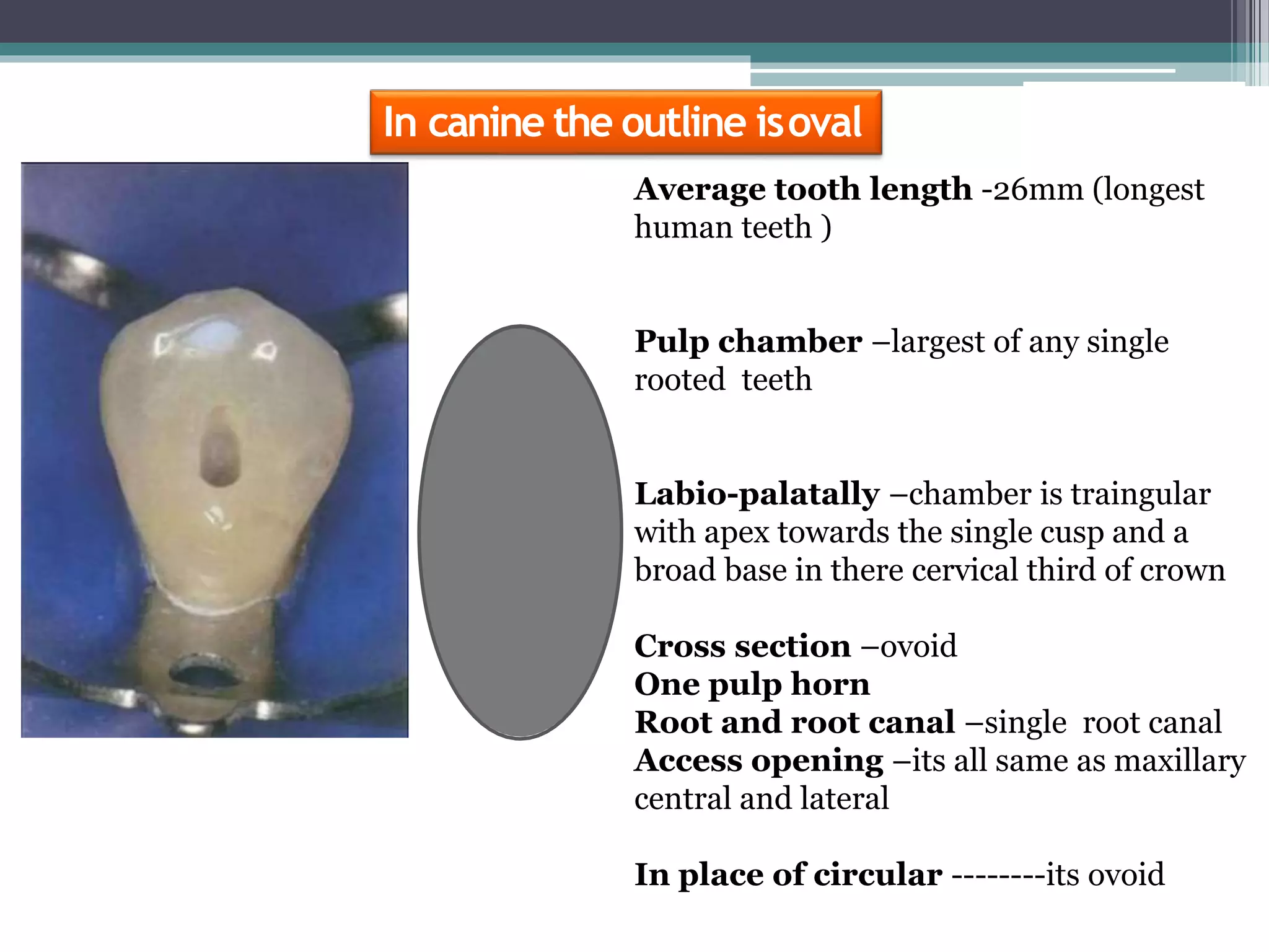 Anatomy of pulp canal and its access opening | PPTX