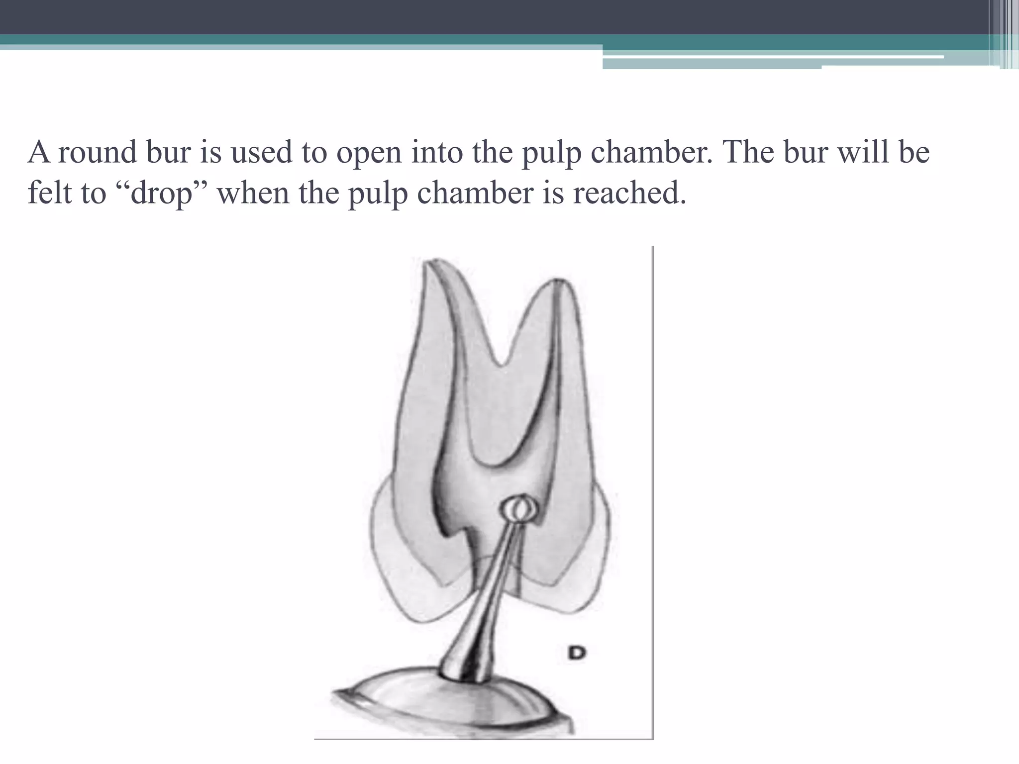 Anatomy of pulp canal and its access opening | PPT