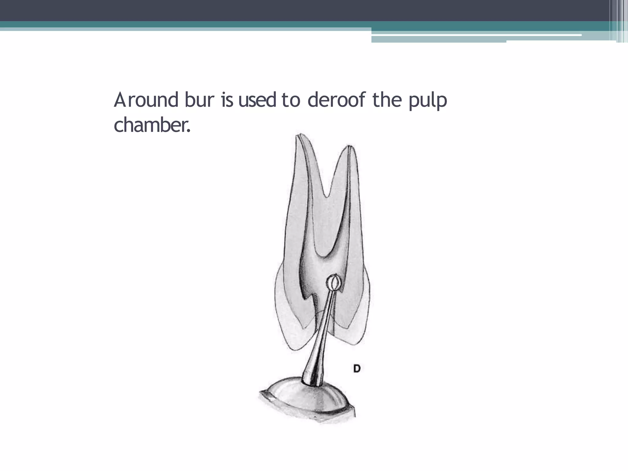 Anatomy of pulp canal and its access opening | PPTX