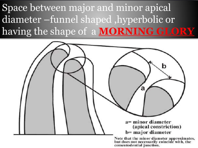 Anatomy of pulp canal and its access opening | PPT