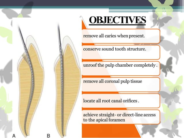 Anatomy of pulp canal and its access opening | PPT