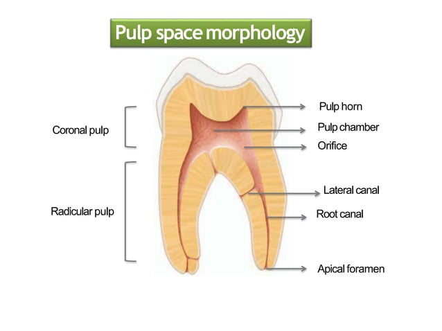 Anatomy of pulp canal and its access opening | PPT