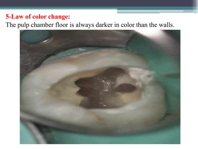 Anatomy of pulp canal and its access opening | PPT