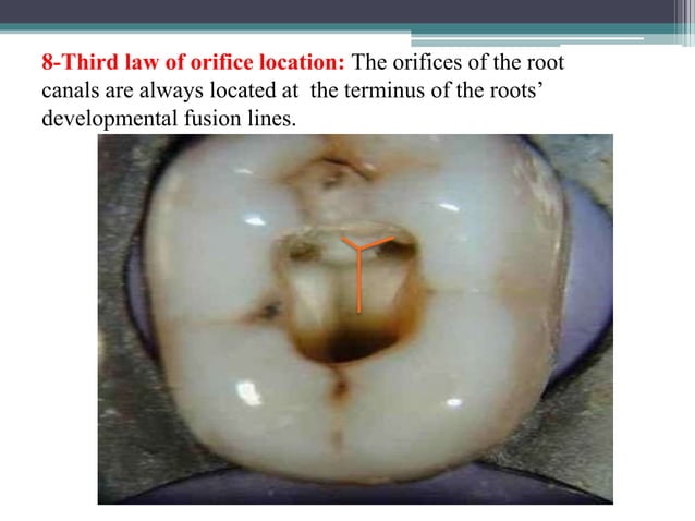 Anatomy of pulp canal and its access opening | PPT