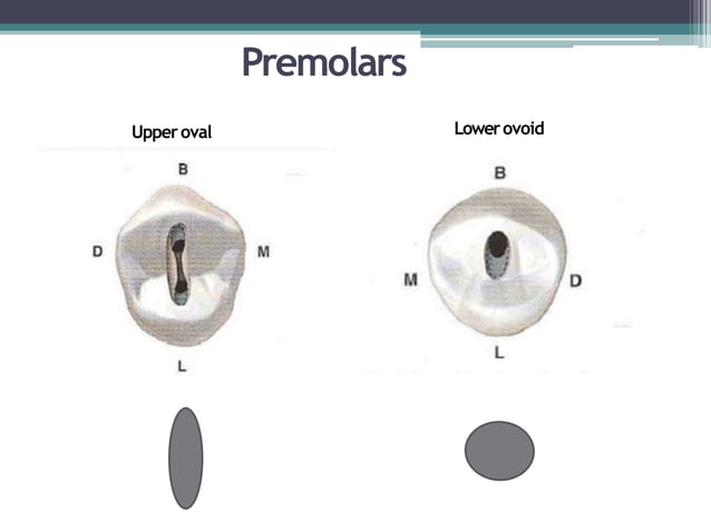 Anatomy of pulp canal and its access opening | PPT