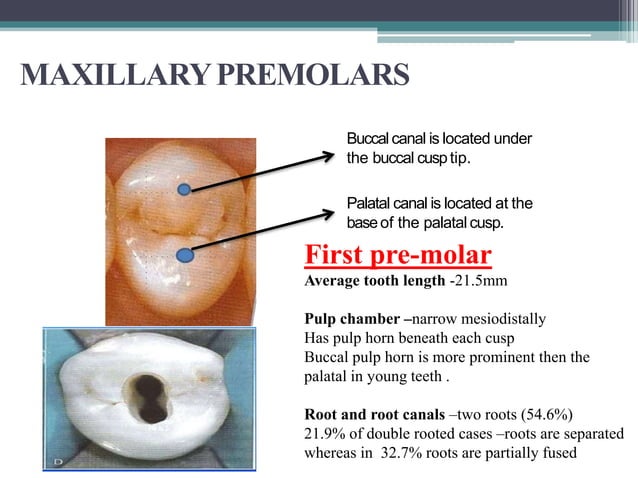 Anatomy of pulp canal and its access opening | PPT