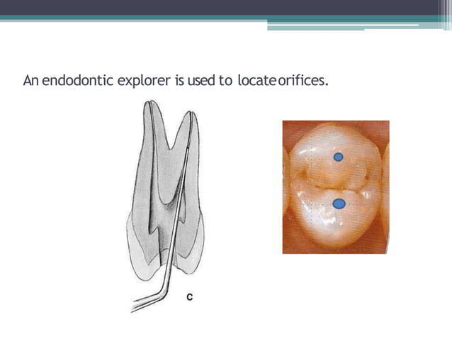 Anatomy of pulp canal and its access opening | PPT