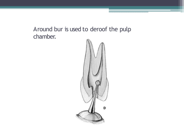 Anatomy of pulp canal and its access opening | PPT