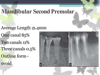 Anatomy of pulp canal and its access opening | PPTX