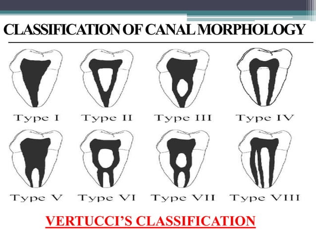 Anatomy of pulp canal and its access opening | PPT