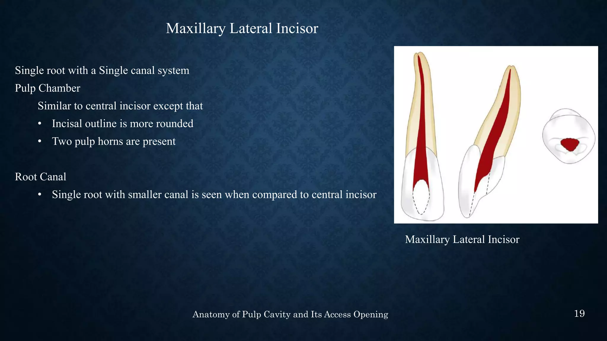 anatomy of pulp cavity and access opening.pptx