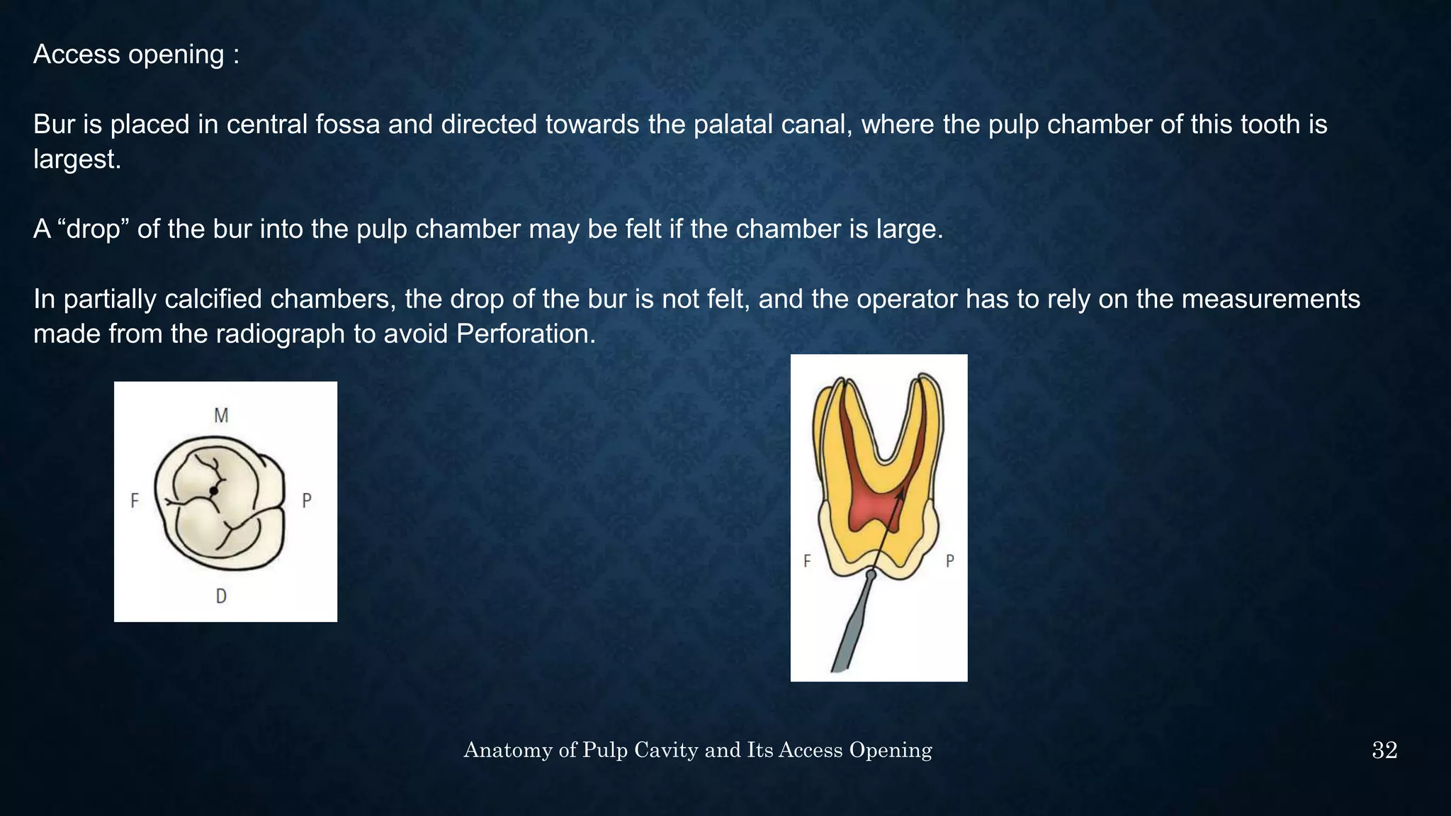 anatomy of pulp cavity and access opening.pptx