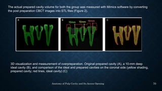 anatomy of pulp cavity and access opening.pptx