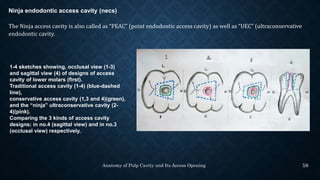 anatomy of pulp cavity and access opening.pptx