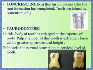 Anatomy of pulp cavity of maxillary teeth (2) | PPTX