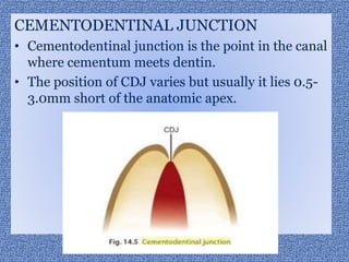 Anatomy of pulp cavity of maxillary teeth (2) | PPT