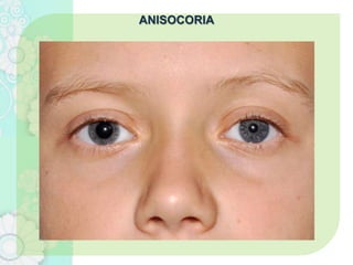 Anatomy of pupillary pathways | PPTX