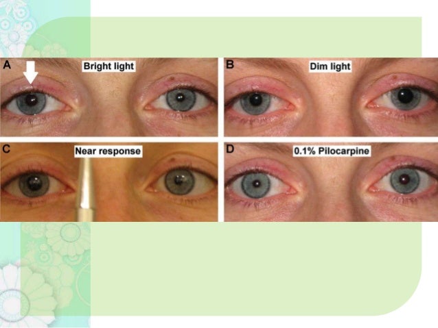 Anatomy of pupillary pathways