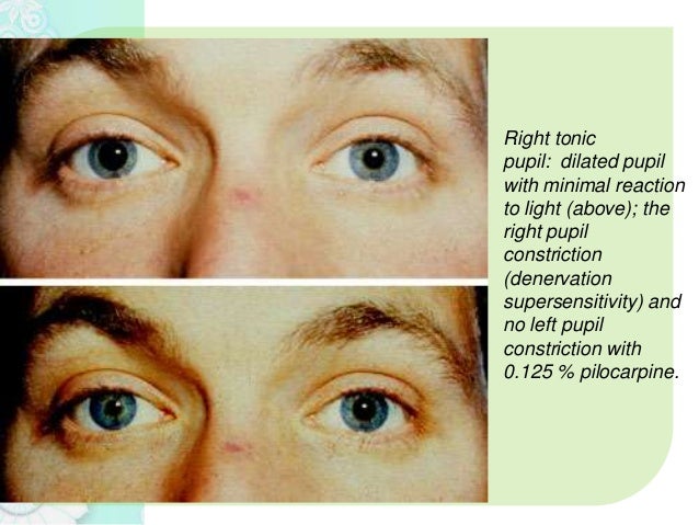 Anatomy of pupillary pathways
