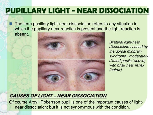 Anatomy of pupillary pathways