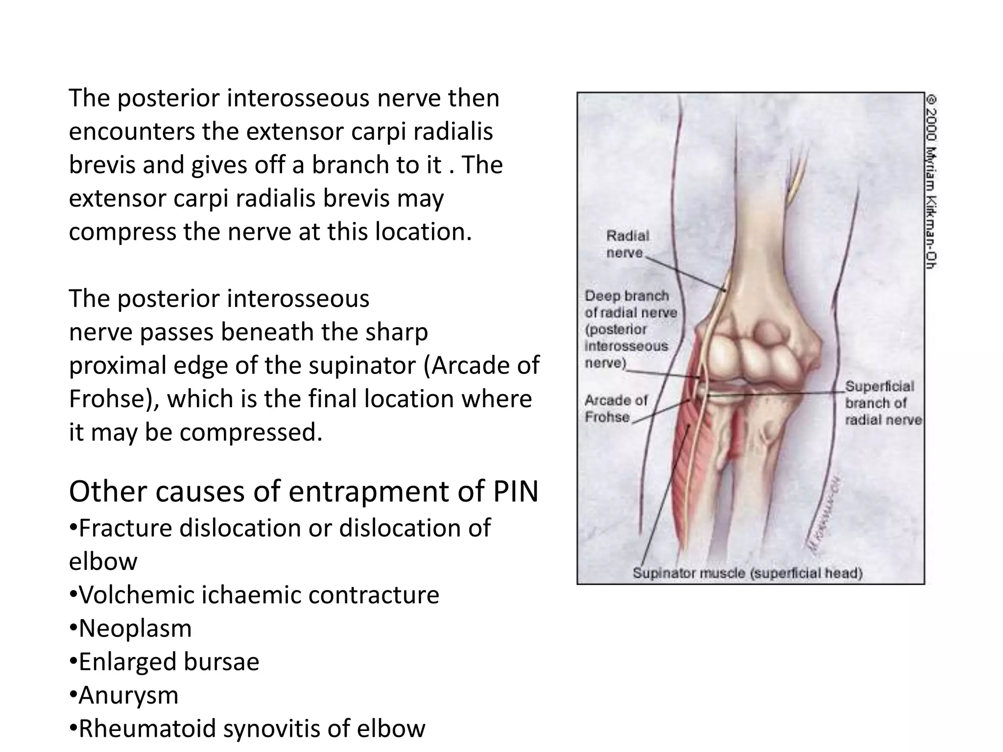 Anatomy of radial,median &ulnar nerve | PPTX