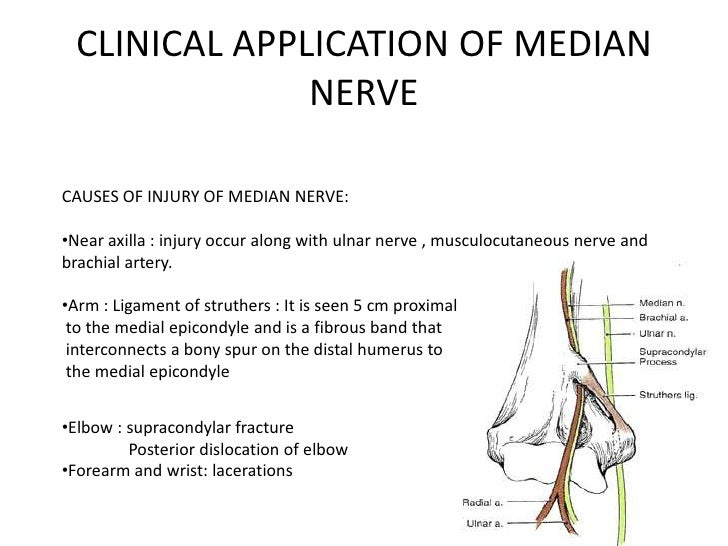 Lesion Ulnar Nerve Entrapment How I Treated Ulnar Nerve Entrapment