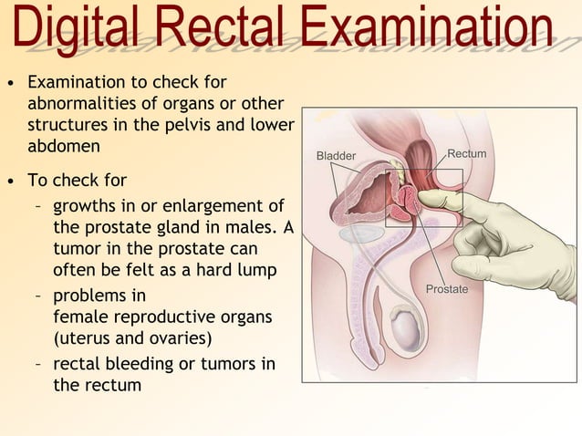 Anatomy of Rectum | PPSX | Digestive Disorders | Diseases and Conditions
