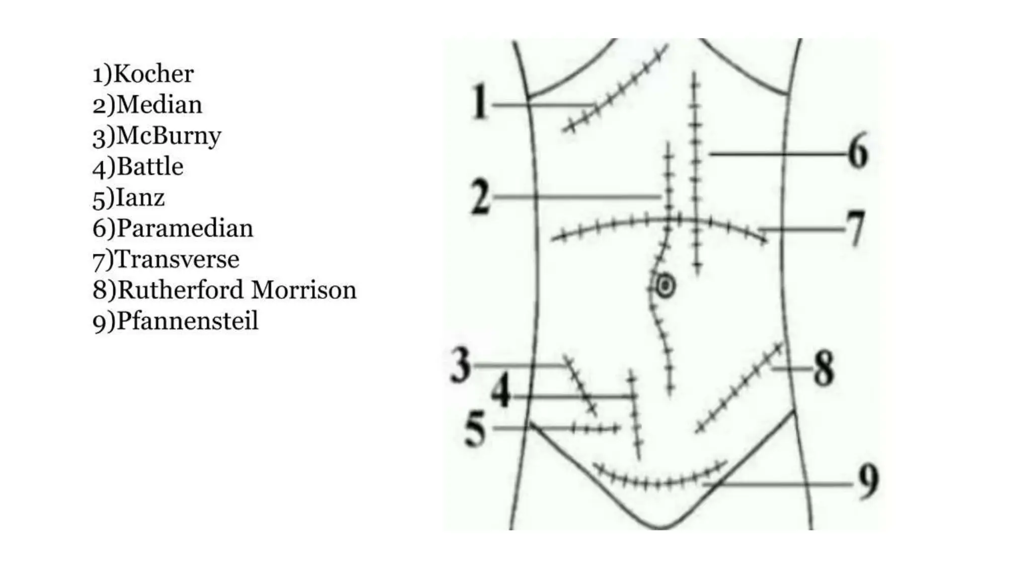 ANATOMY OF RECTUS in OBST AND GYNAE.pptx