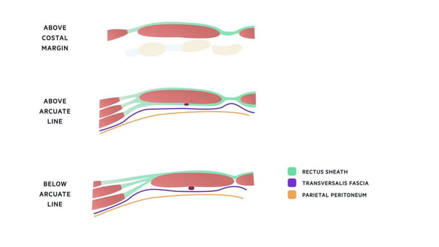 ANATOMY OF RECTUS in OBST AND GYNAE.pptx