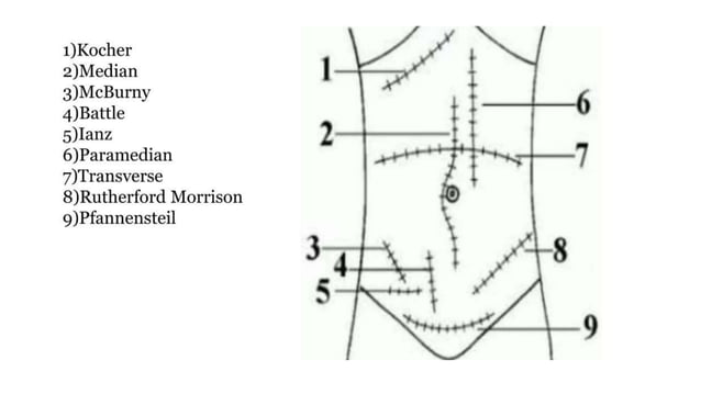 ANATOMY OF RECTUS in OBST AND GYNAE.pptx