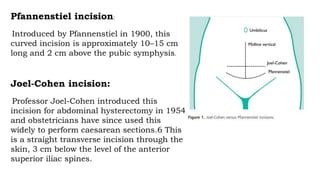 ANATOMY OF RECTUS in OBST AND GYNAE.pptx