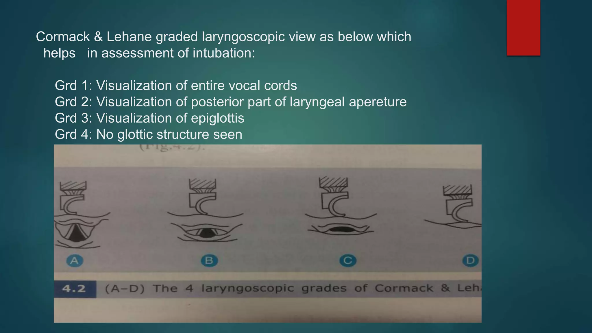 Anatomy of respiratory system | PPTX