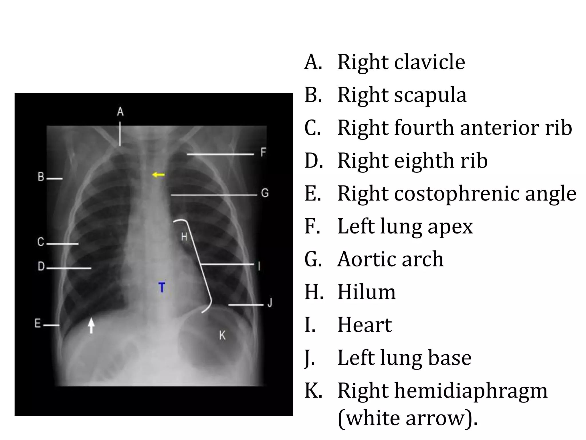 Respiratory System - Anatomy | PPSX