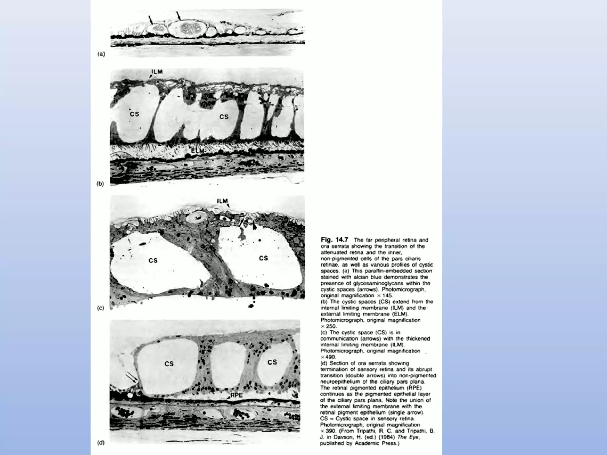 Anatomy of Retina | PPT