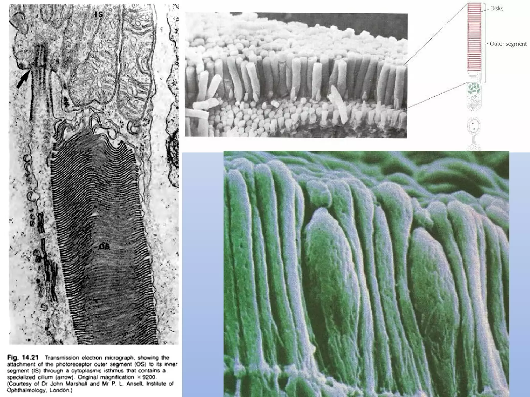 Anatomy of Retina | PPT